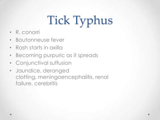 Typhus: the Rickettsial Disease | PPTX