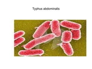 Typhus_Abdominalis_adalah penyakit infeksi.ppt