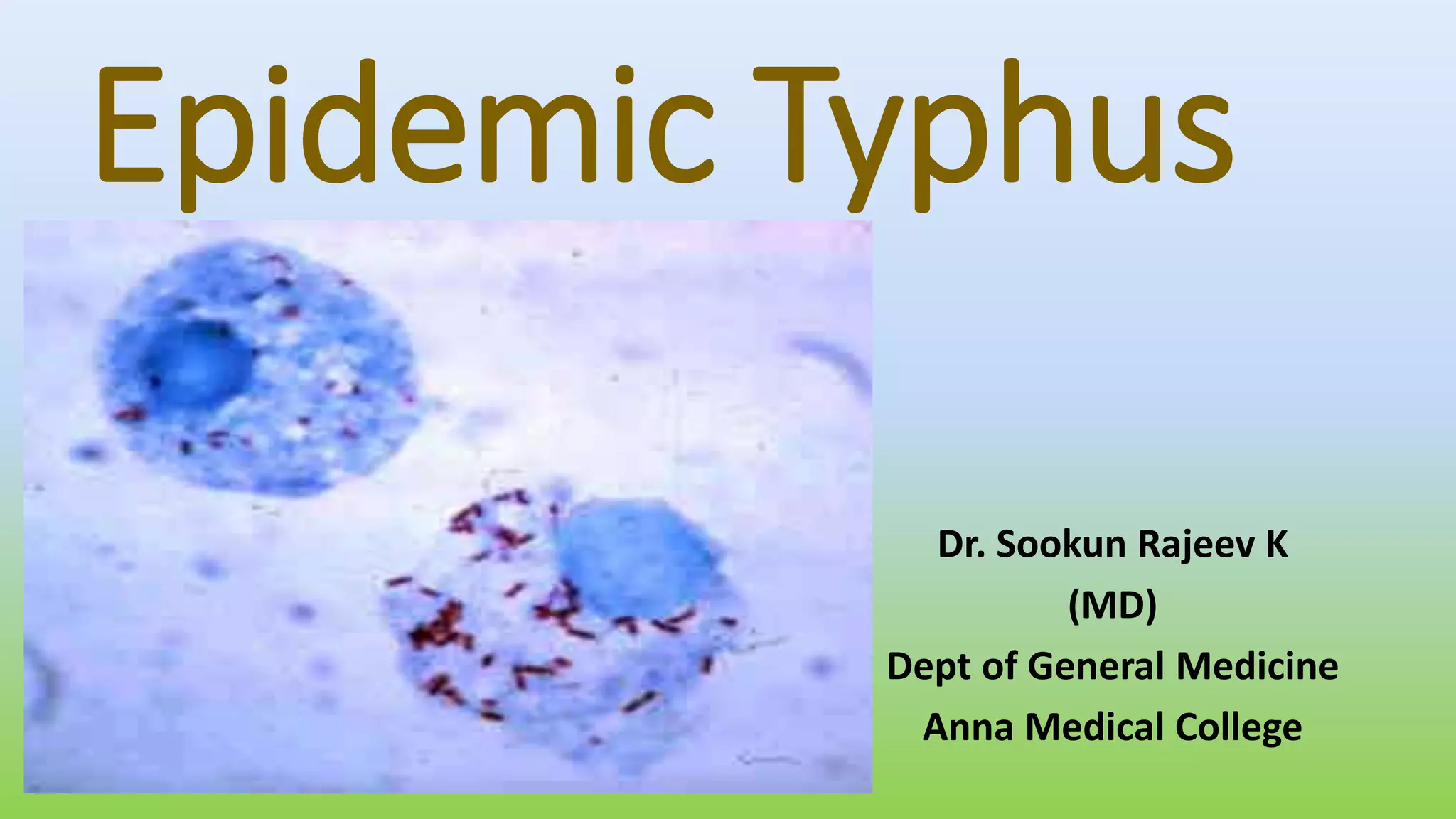 Typhus Fever by Dr. Sookun Rajeev Kumar | PPTX