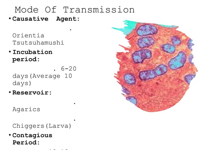 Typhus Fever and its epidemiology worldwide.pptx