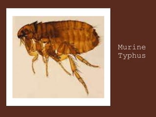 Typhus Fever and its epidemiology worldwide.pptx