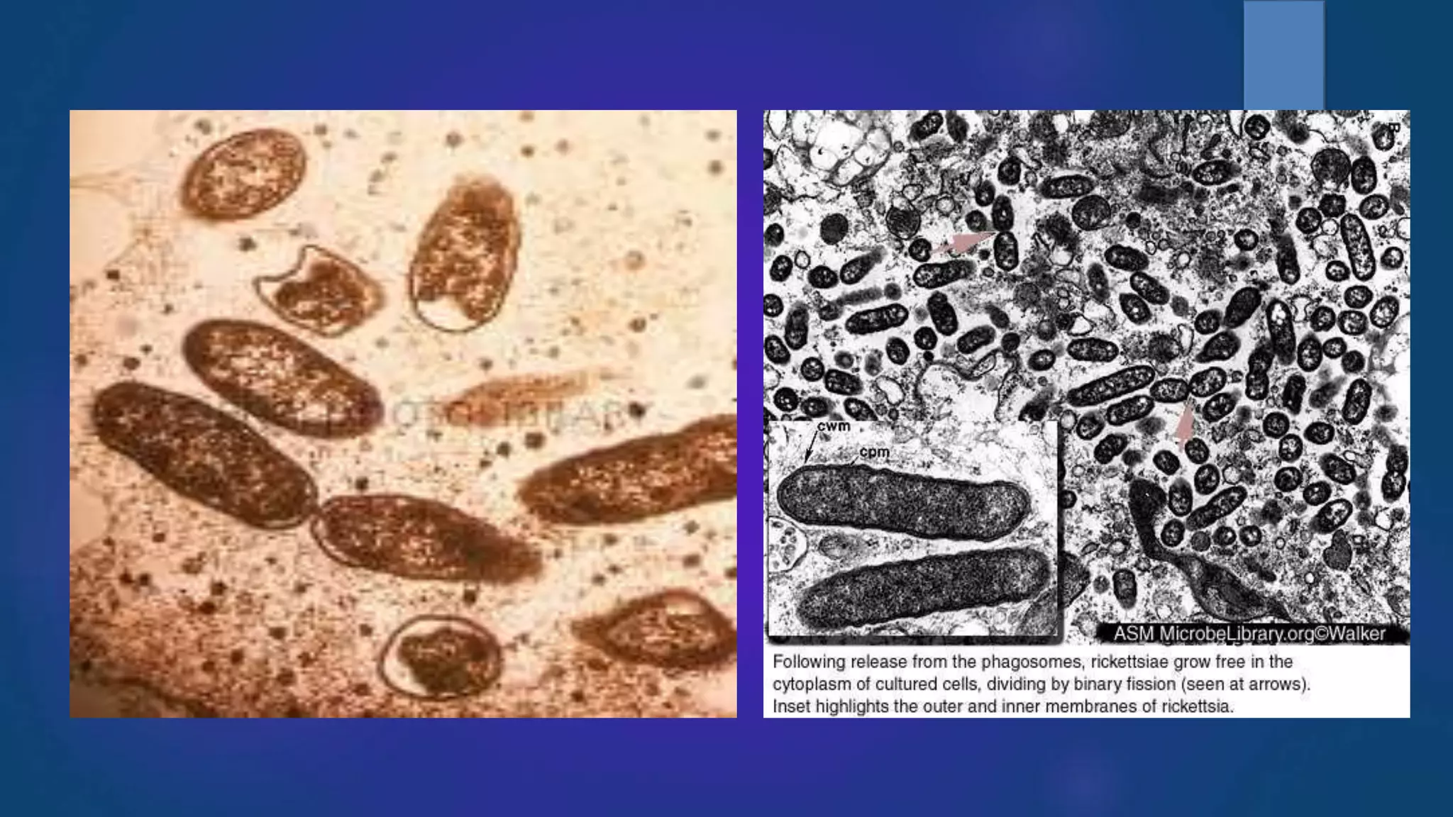 Typhus , yellow , dengue ..also deals with causative agents insects ...