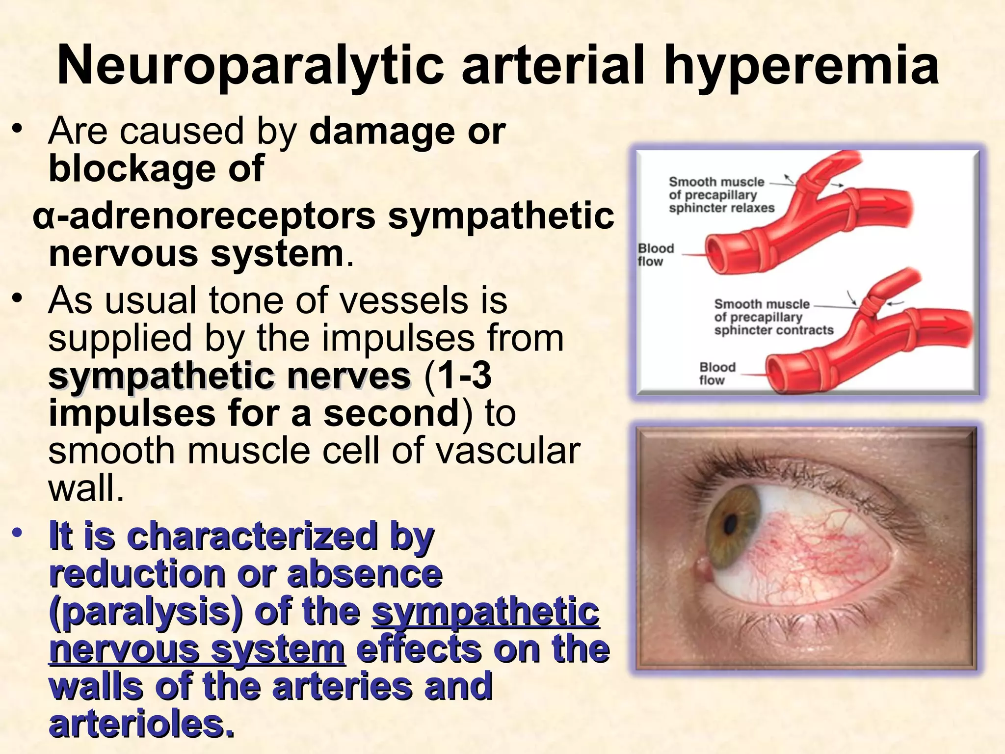 Typical disorders of peripheral blood flow | PPT