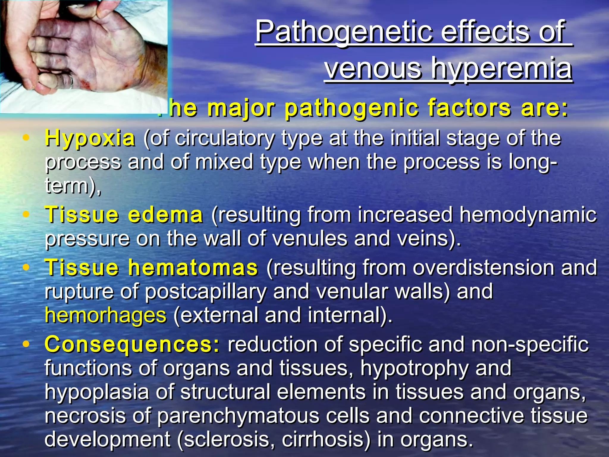 Typical disorders of peripheral blood flow | PPT