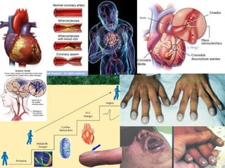Typical disorders of peripheral blood flow | PPT