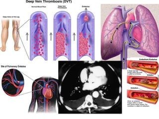 Typical disorders of peripheral blood flow | PPT