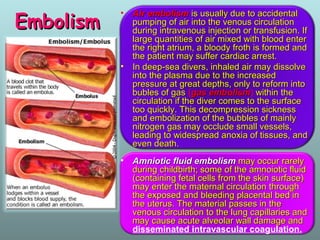 Typical disorders of peripheral blood flow | PPT
