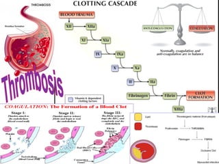 Typical disorders of peripheral blood flow | PPT
