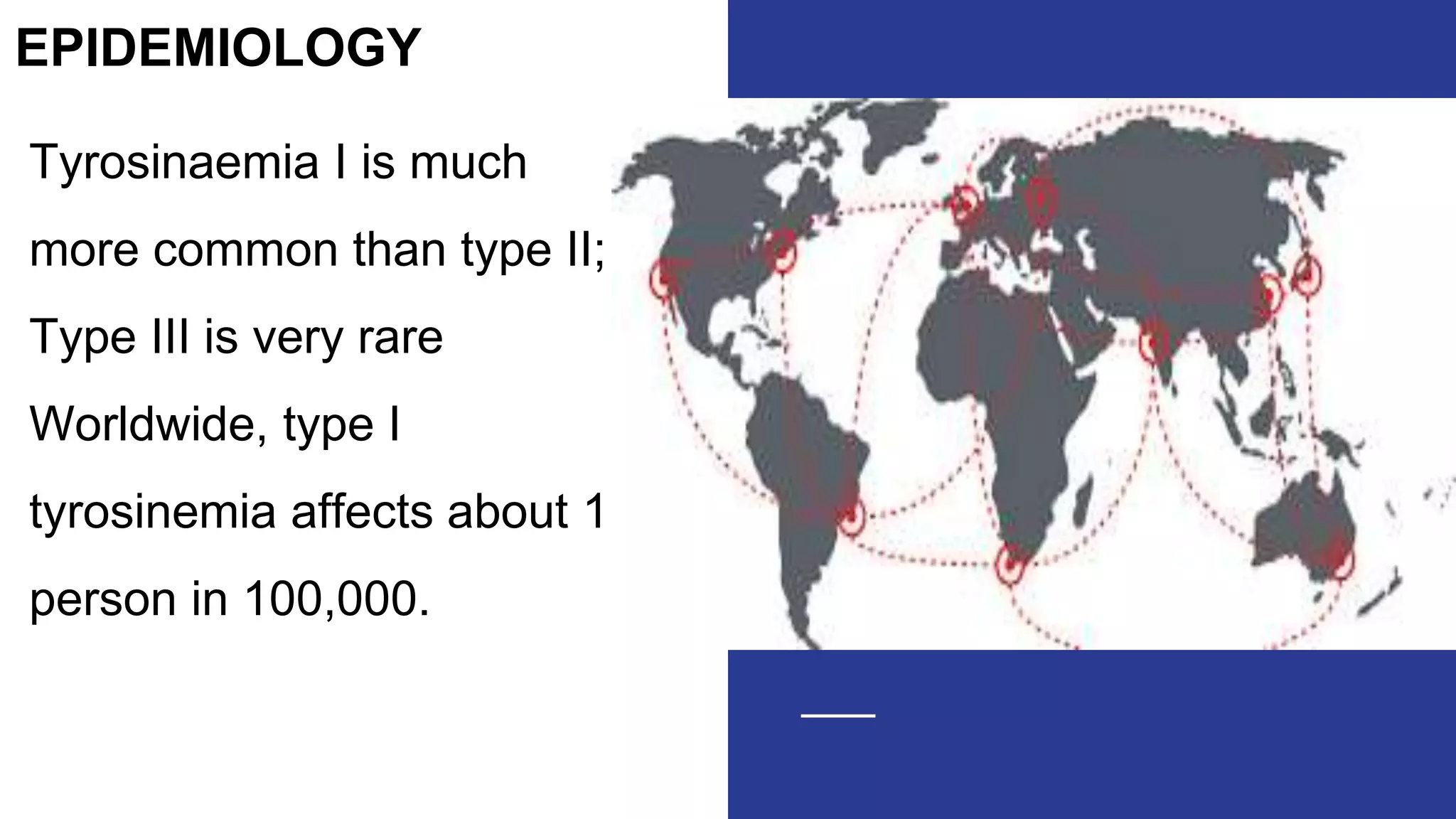 Tyrosinosis | PPTX