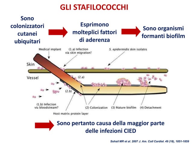 Tyrx ostacola il biofilm sui CIED | PPT