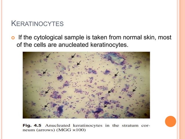 Tzanck Smear | PPTX