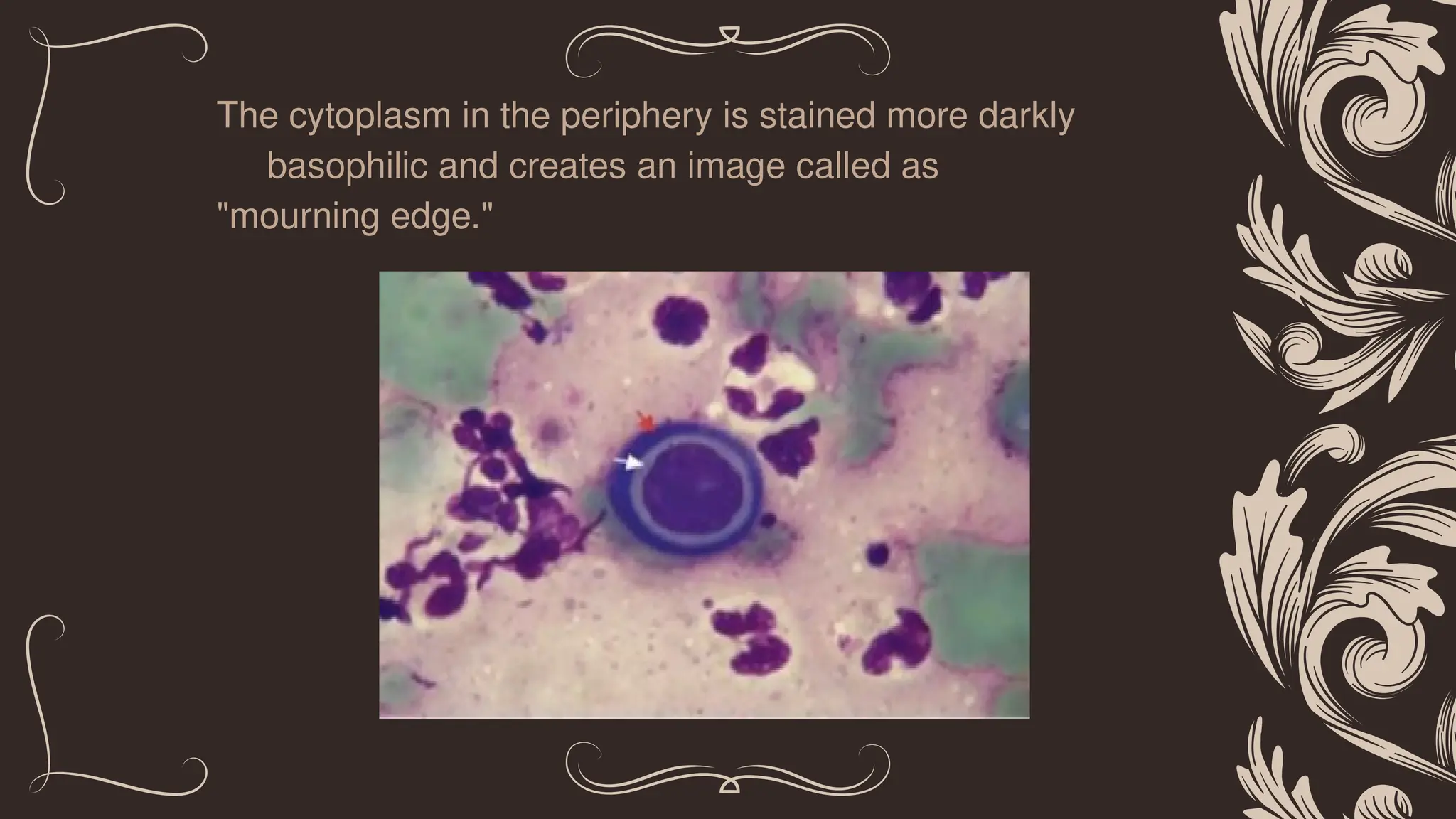 tzanck smear in psoriasis - investigation | PPTX