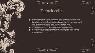 tzanck smear in psoriasis - investigation | PPT