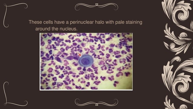 tzanck smear in psoriasis - investigation | PPT