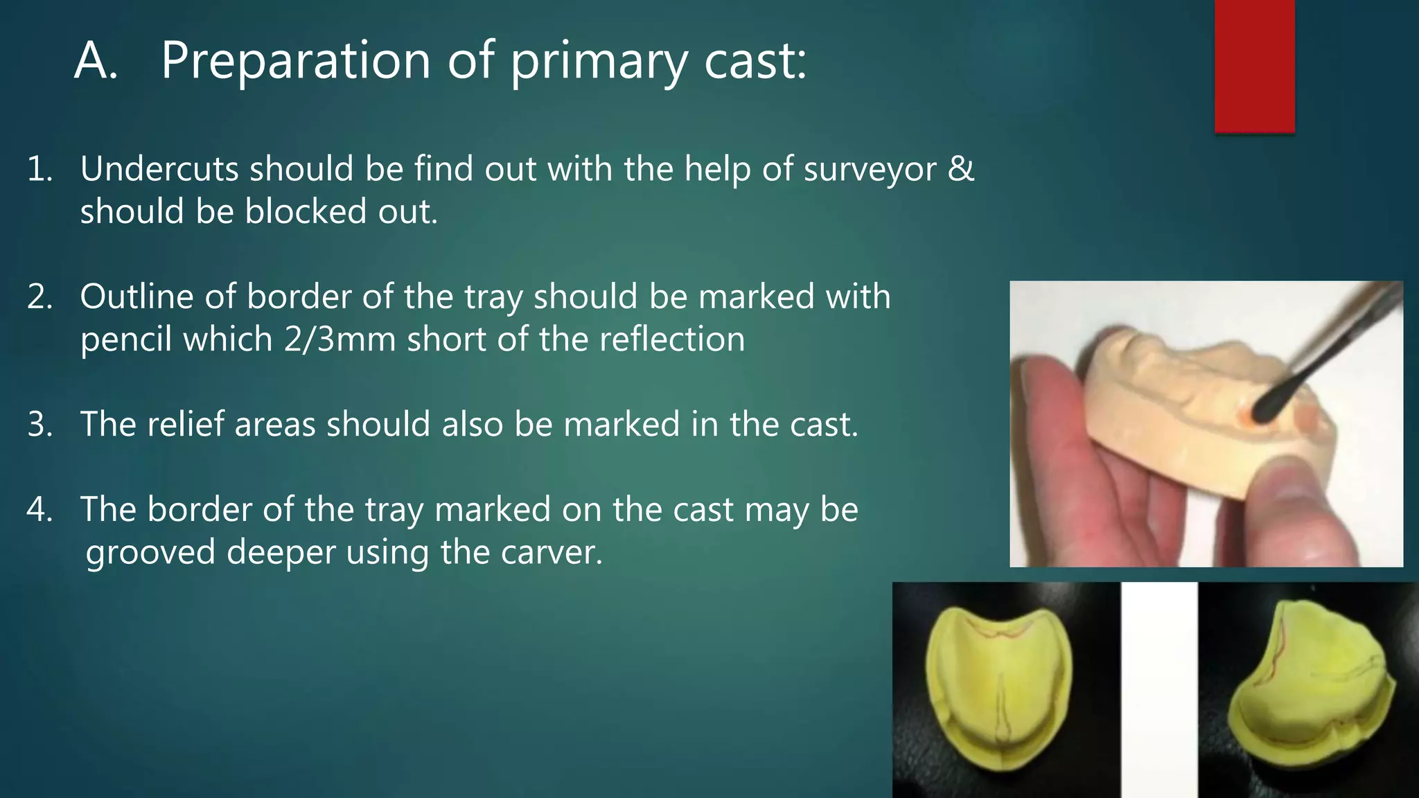 Special tray prosthodontics | PPTX