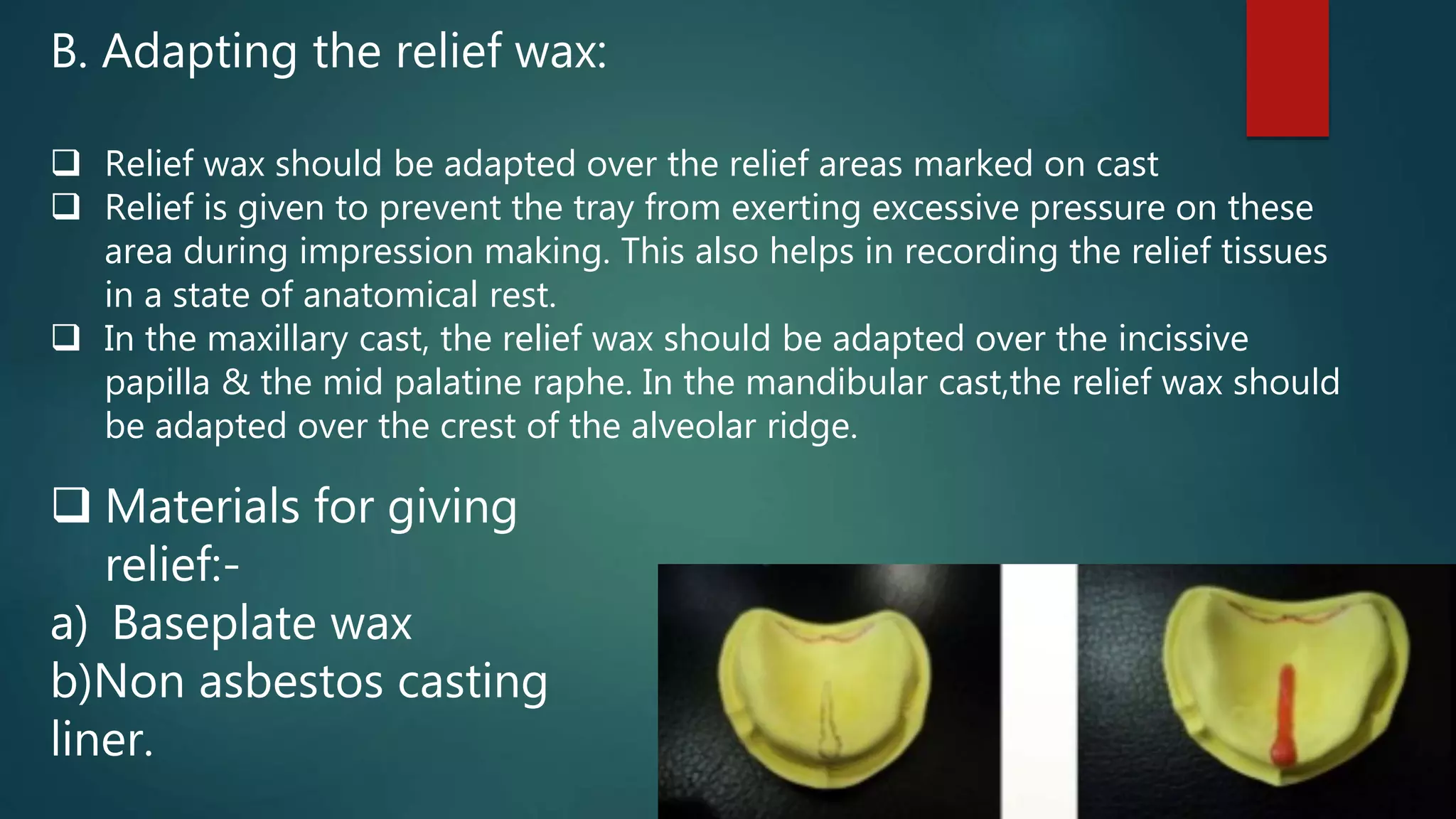 Special tray prosthodontics | PPTX