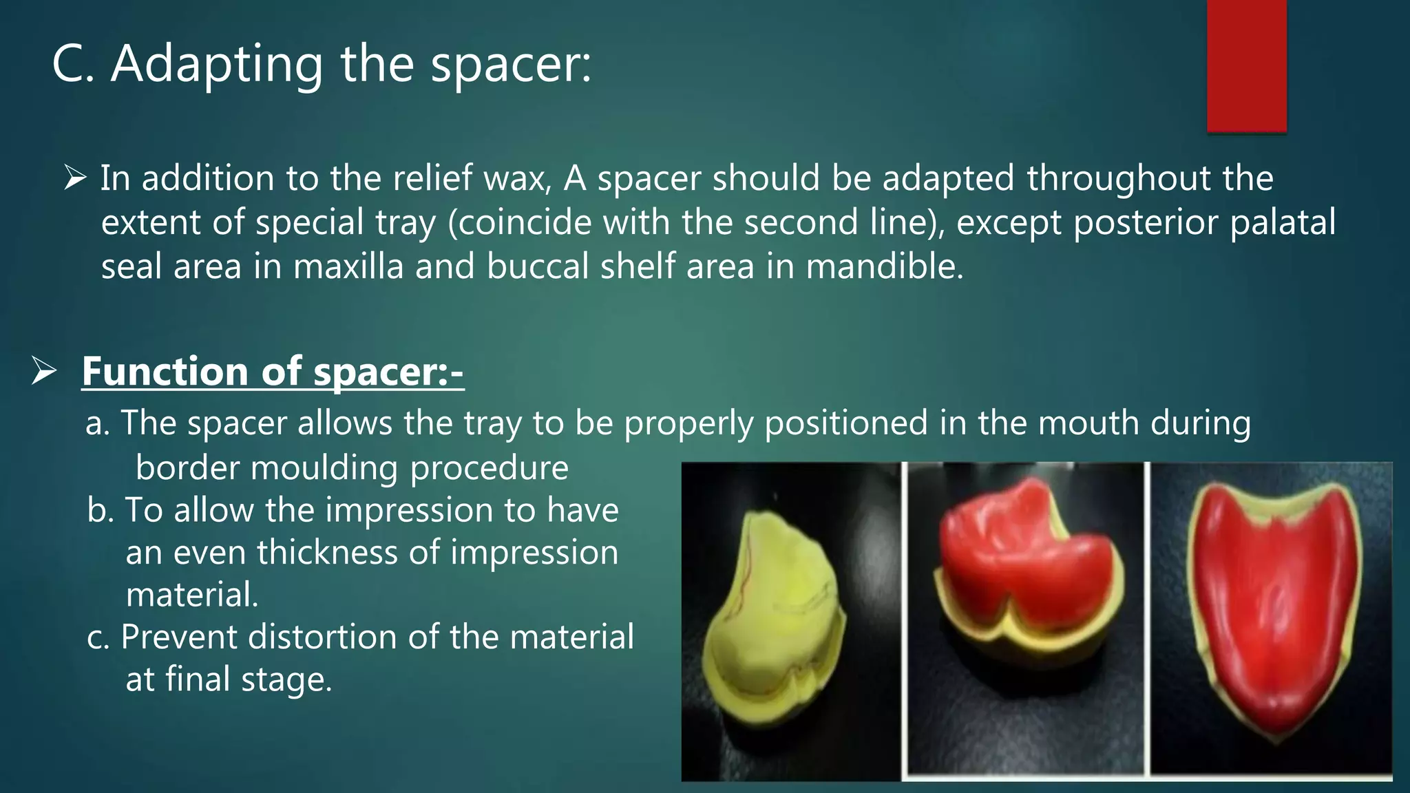 Special tray prosthodontics | PPTX