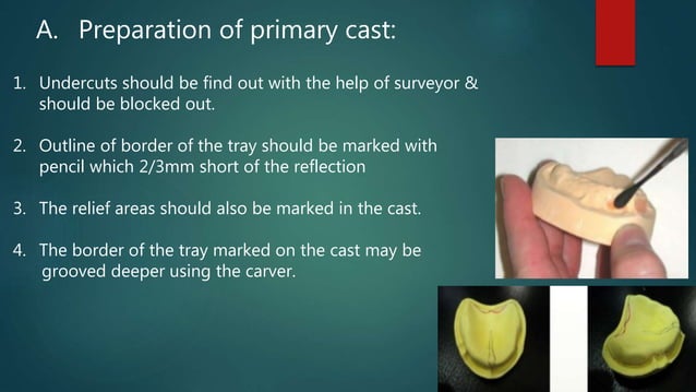 Special tray prosthodontics | PPTX | Oral care | Personal Care