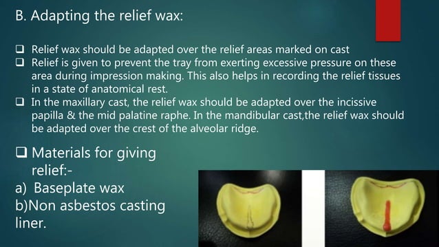 Special tray prosthodontics | PPTX | Oral care | Personal Care