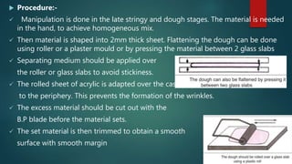 Special tray prosthodontics | PPTX