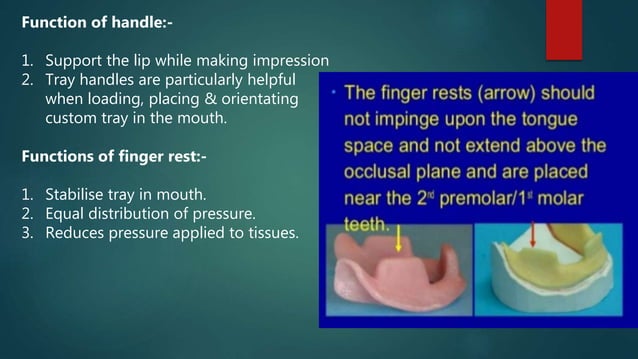 Special tray prosthodontics | PPTX | Oral care | Personal Care