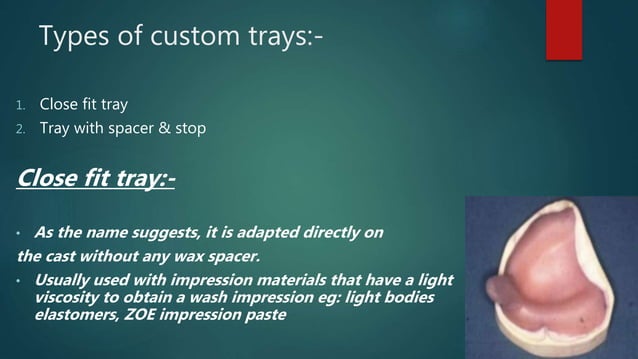 Special tray prosthodontics | PPTX | Oral care | Personal Care
