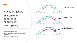 DSAEK VS. DMEK.pptx