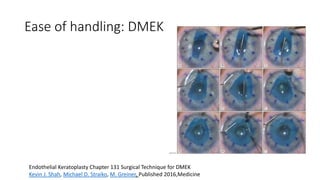 DSAEK VS. DMEK.pptx