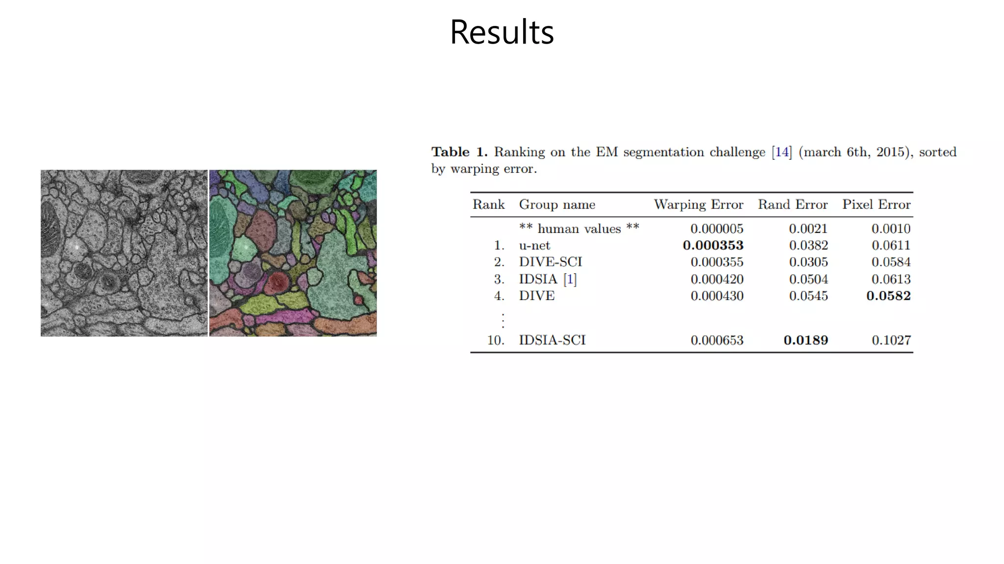 U Net Convolutional Networks For Biomedical Image Segmentation Ppt 