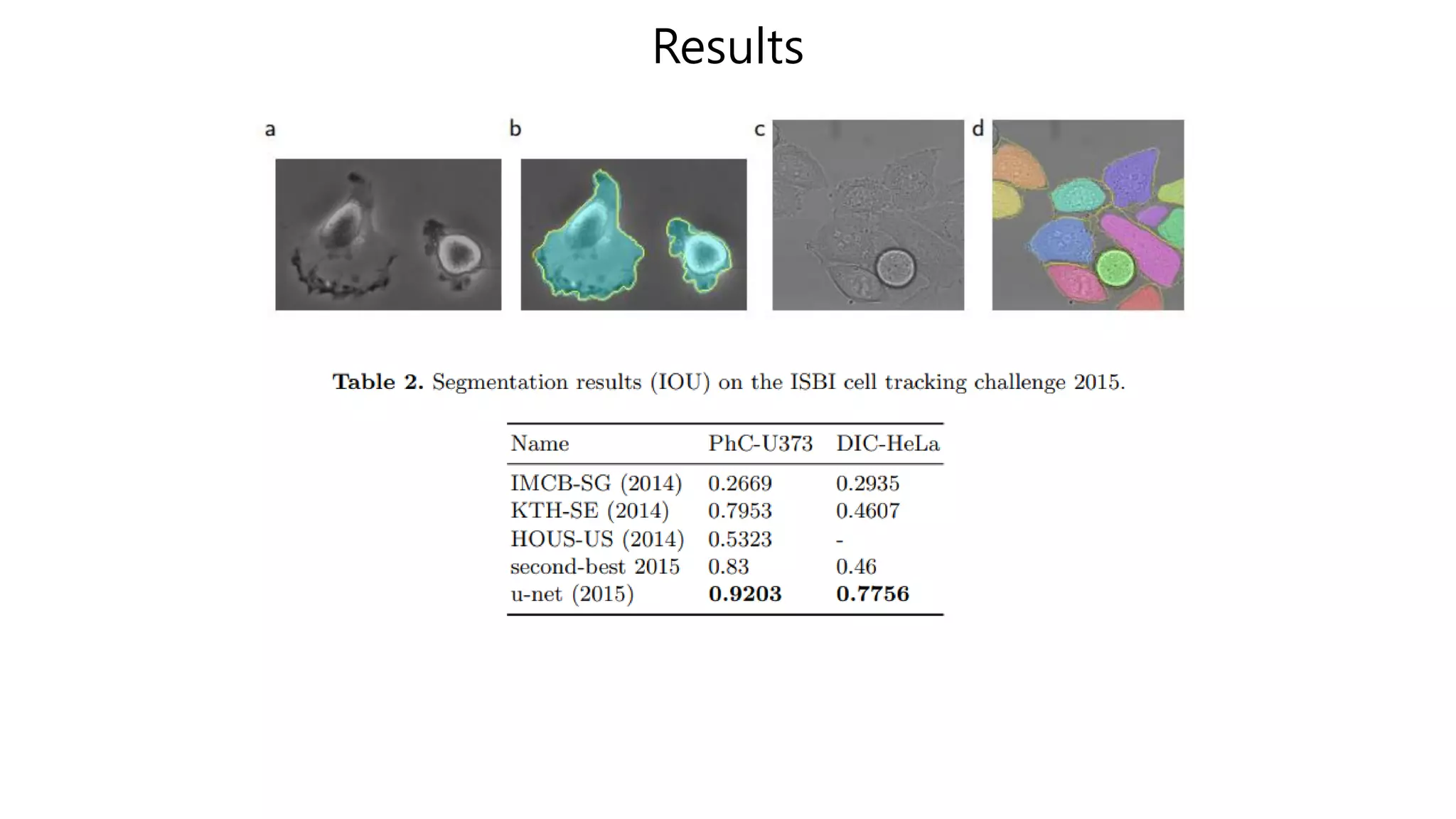U Net Convolutional Networks For Biomedical Image Segmentation Ppt
