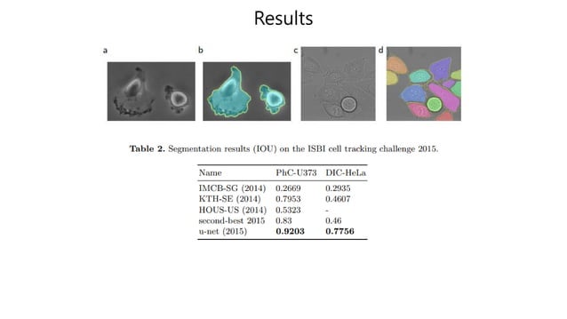 U Net Convolutional Networks For Biomedical Image Segmentation 6670