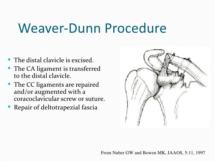 U01 clavicle ac_sc_joints1