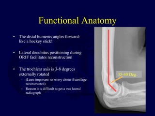 2-Distal Humerus Fractures in eldarly pt | PDF