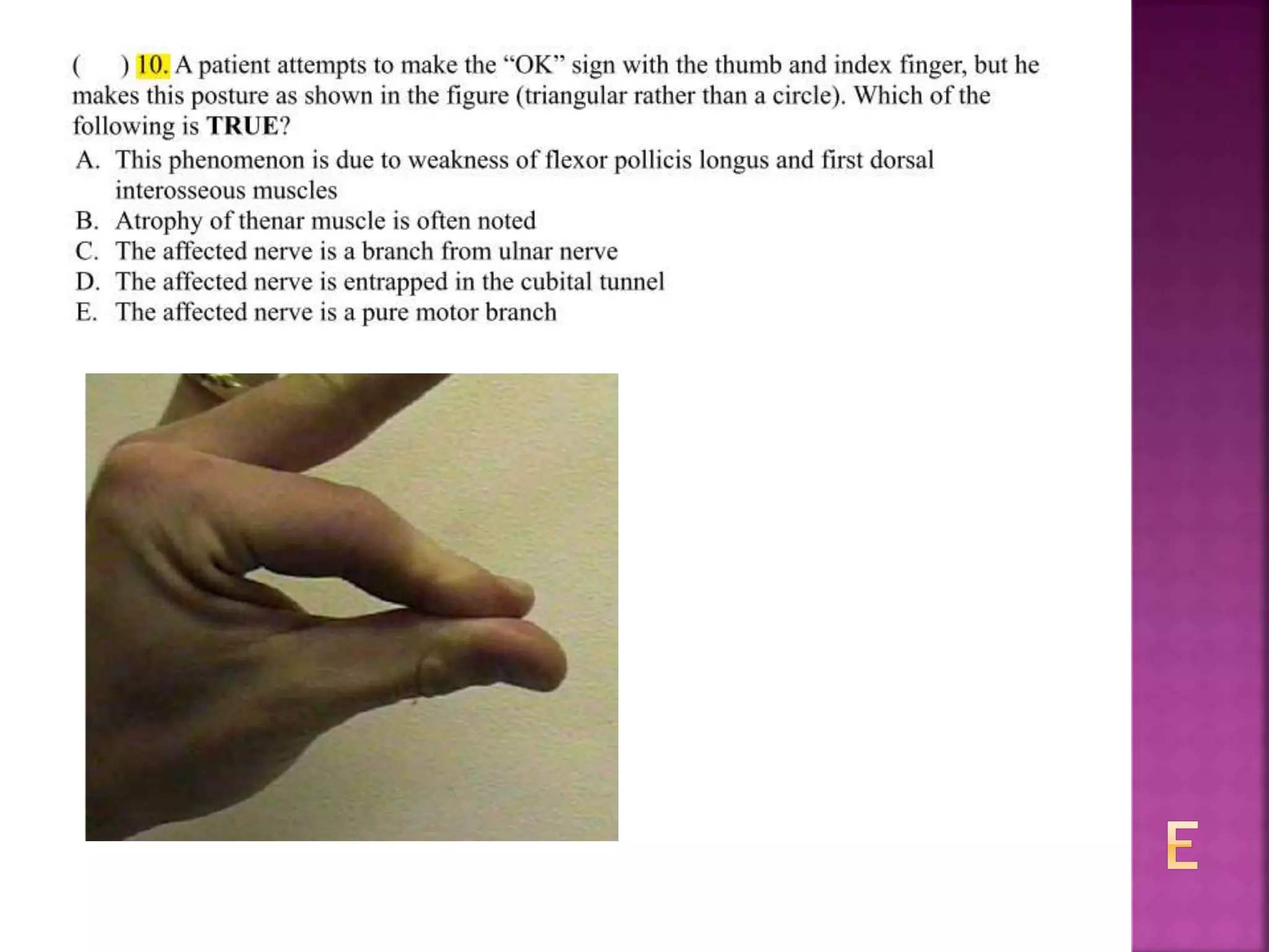 Plexopathy and mononeuropathy (test with answer) | PPT