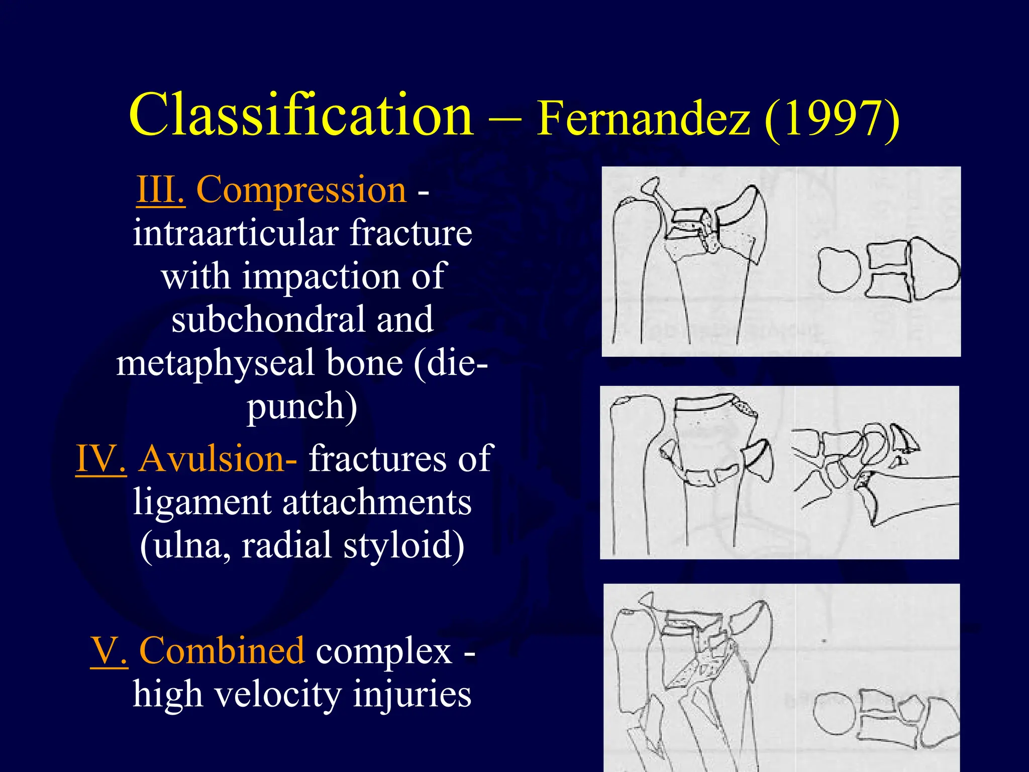 Distal Radius Fractures(DER) colless.pdf