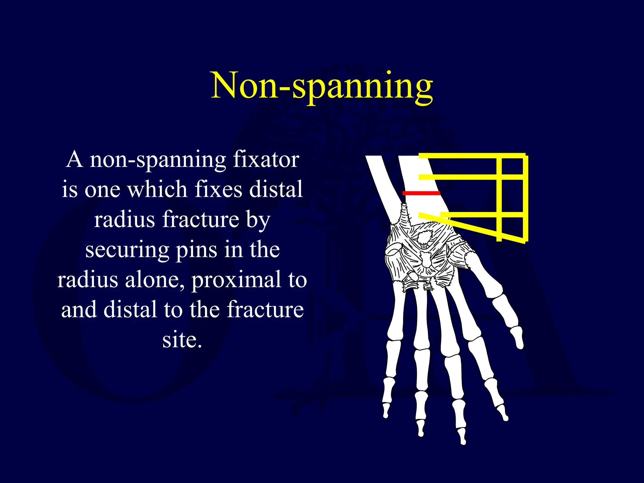 Distal Radius Fractures(DER) colless.pdf