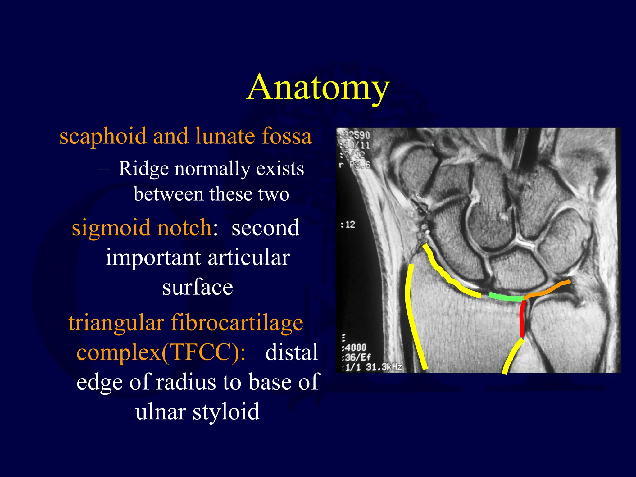Distal Radius Fractures(DER) colless.pdf