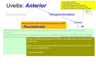 UVEITIS ANTERIOR DESCRIPCION pptx | PPTX