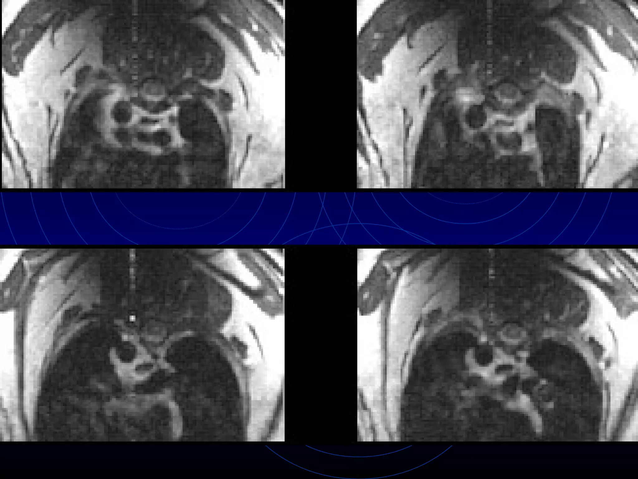 100 non enhancement mri of rabbit | PPT