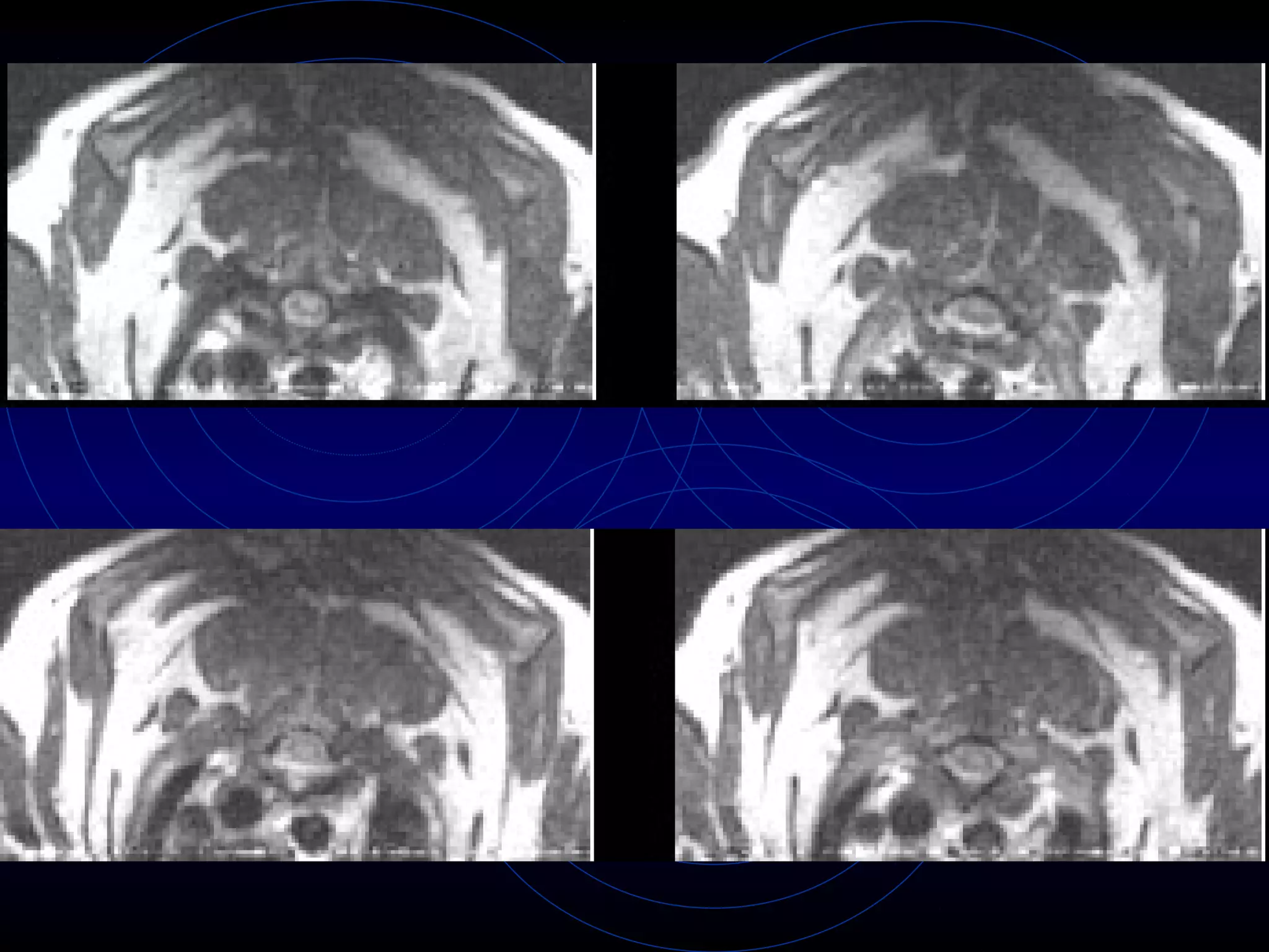 100 non enhancement mri of rabbit | PPT