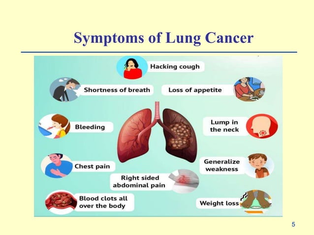 Lung cancer - definition, causes, symptoms, diagnosis, treatment ...