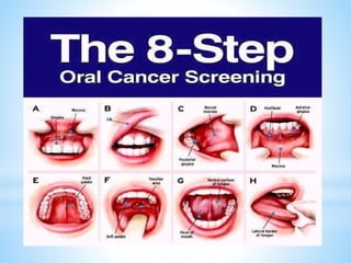 Oral cancer - definition, causes, risks, symptoms, diagnosis and ...