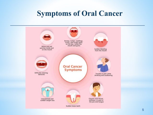 Oral cancer - definition, causes, risks, symptoms, diagnosis and ...