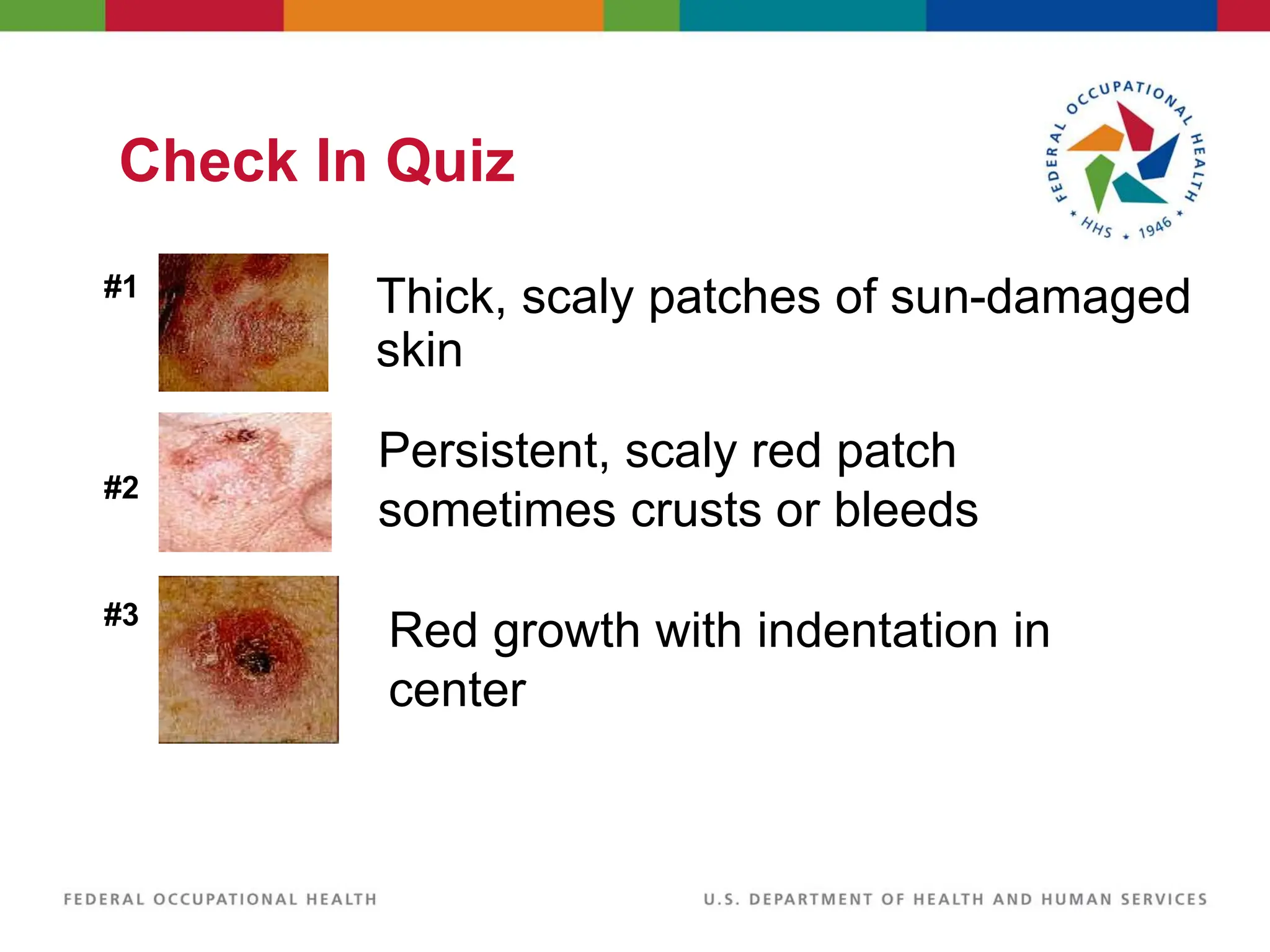 Oral cancer - definition, causes, risks, symptoms, diagnosis and ...