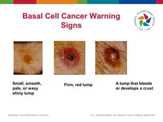 Oral cancer - definition, causes, risks, symptoms, diagnosis and ...