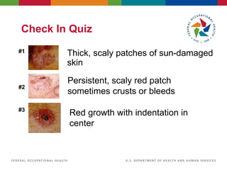 Oral cancer - definition, causes, risks, symptoms, diagnosis and ...