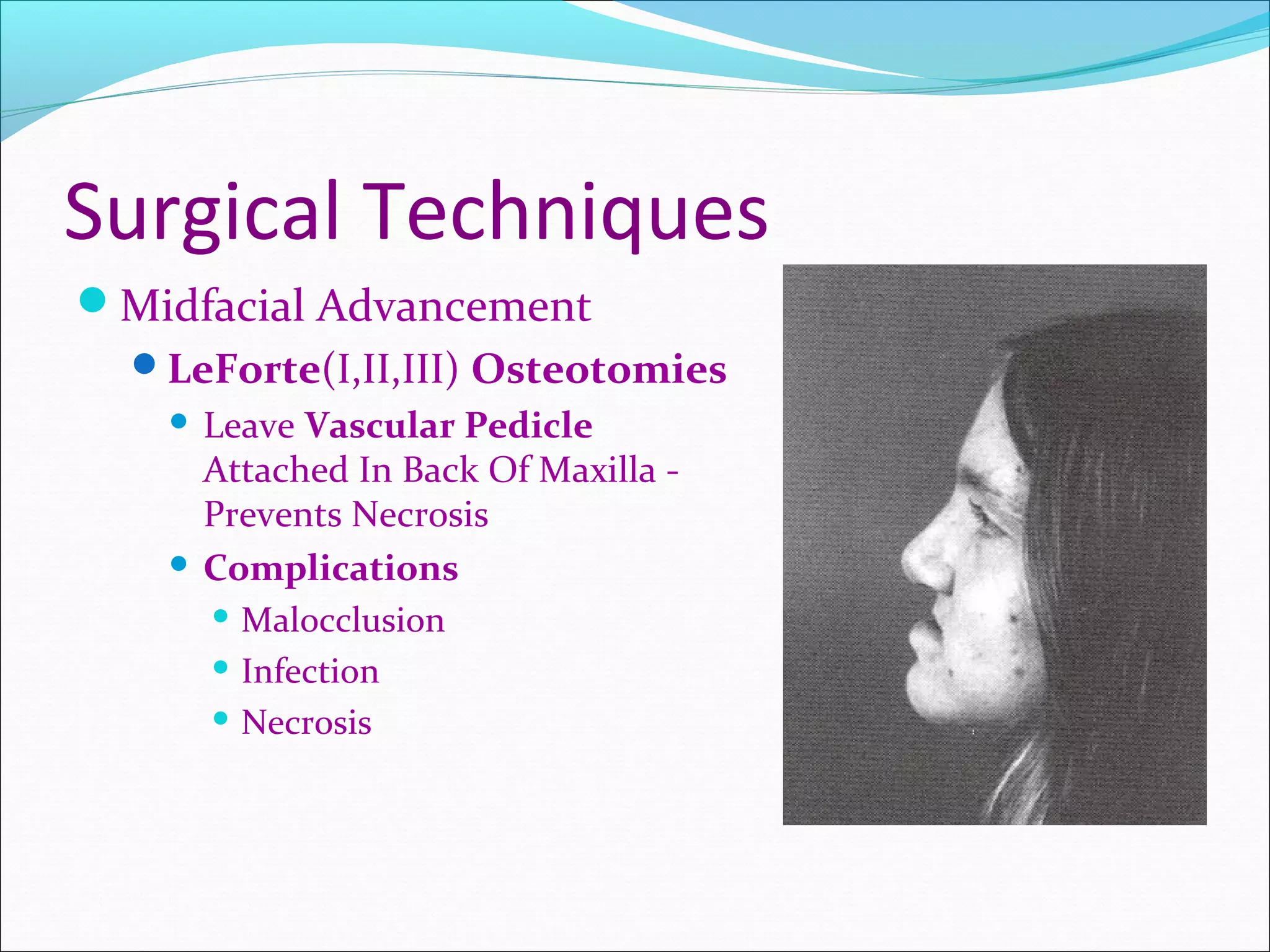 Clinical aspects of cleft lip and palate reconstruction 2 rec | PPT