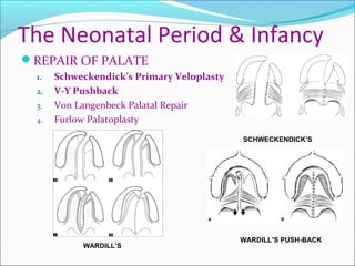 Clinical aspects of cleft lip and palate reconstruction 2 rec | PPT