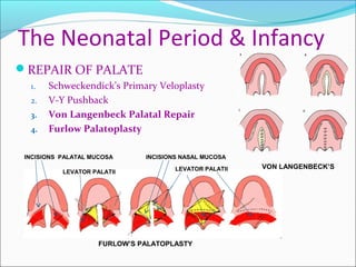 Clinical aspects of cleft lip and palate reconstruction 2 rec | PPT ...