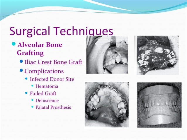 Clinical aspects of cleft lip and palate reconstruction 2 rec | PPT ...
